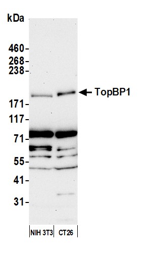 Anti-TopBP1 | Bethyl Laboratories | Biomol.com