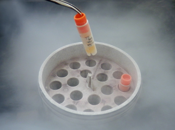 WM115 Viable Cells | Rockland Immunochemicals | Biomol.com