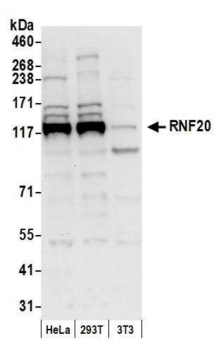 Anti-RNF20 | Bethyl Laboratories | Biomol.com