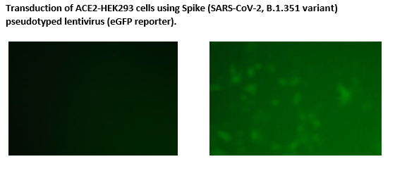 Spike (beta B.1.351 Variant) (SARS-CoV-2) Pseudotyped Lentivirus (eGFP Reporter) | BPS ...