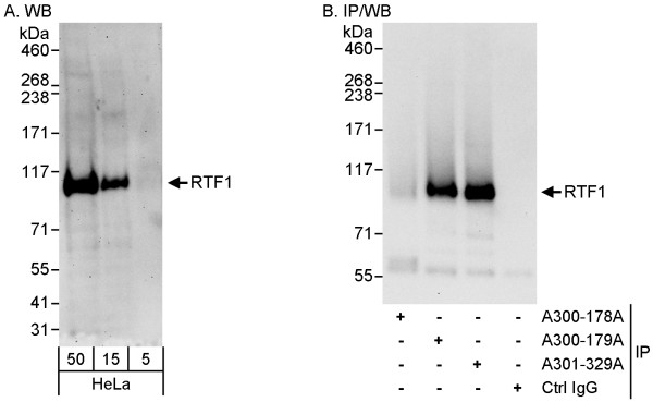 Anti-Rtf1 | Bethyl Laboratories | Biomol.com