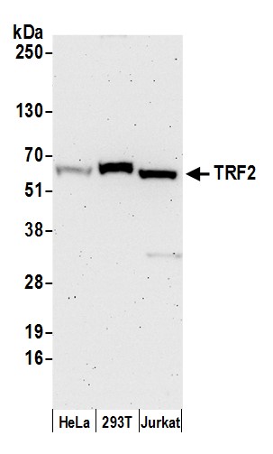 Anti-TRF2 | Bethyl Laboratories | Biomol.com