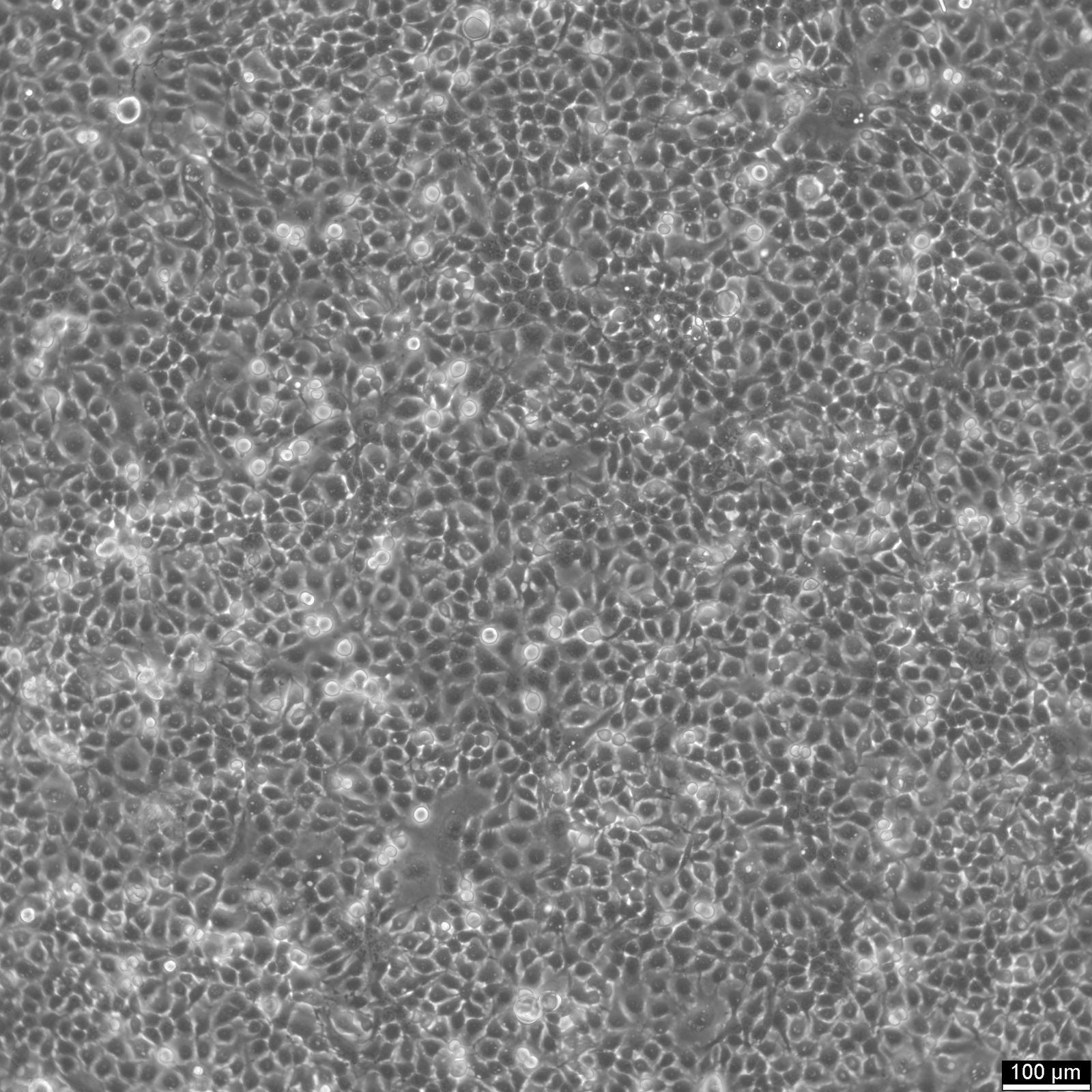 KYSE-150 Cells | Cytion | Biomol.com